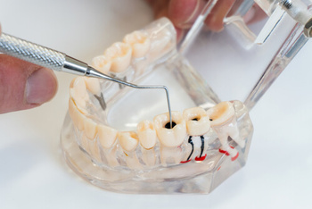 Dos and Don'ts After Tooth Filling for Optimal Recovery